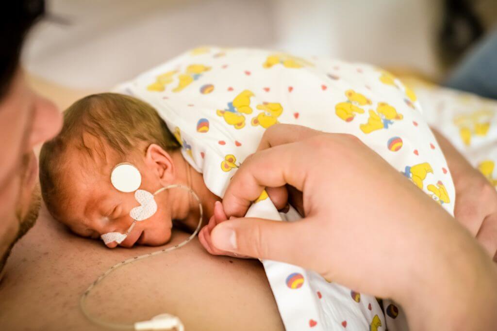 Imaging the Encephalopathic Infant - East of England